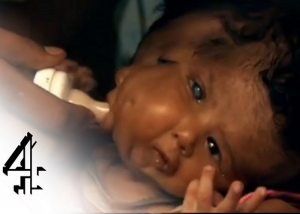 This Girl Has Two Faces, An Exceptionally Rare Case